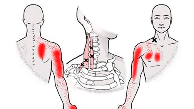 Onverklaarbare pijn op de borst - Van Rein Instituut B.V.
