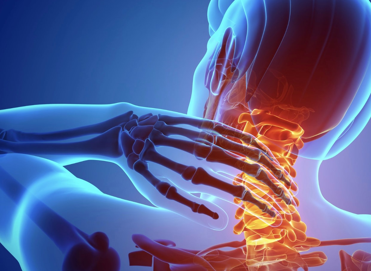 Als je nek je nekt... - Van Rein Instituut B.V.